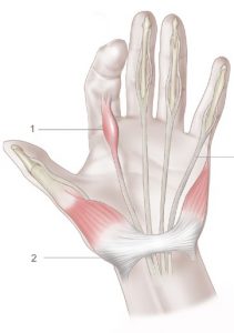 Deget în resort (deget blocat) - Clinica Angi San Buzău